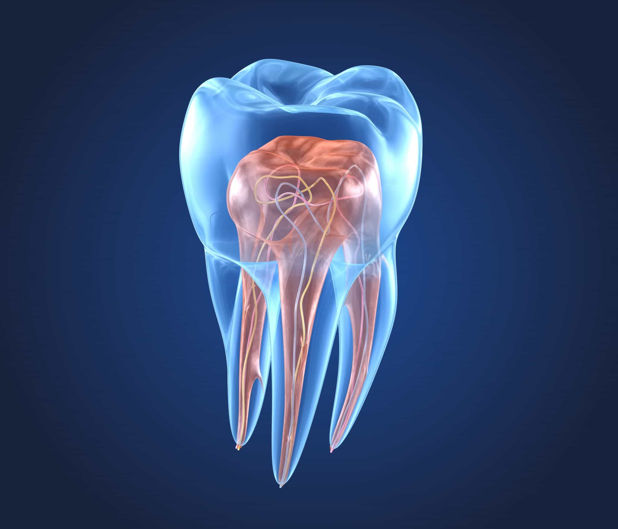 Treating Internal Tooth Decay | Leawood, KS